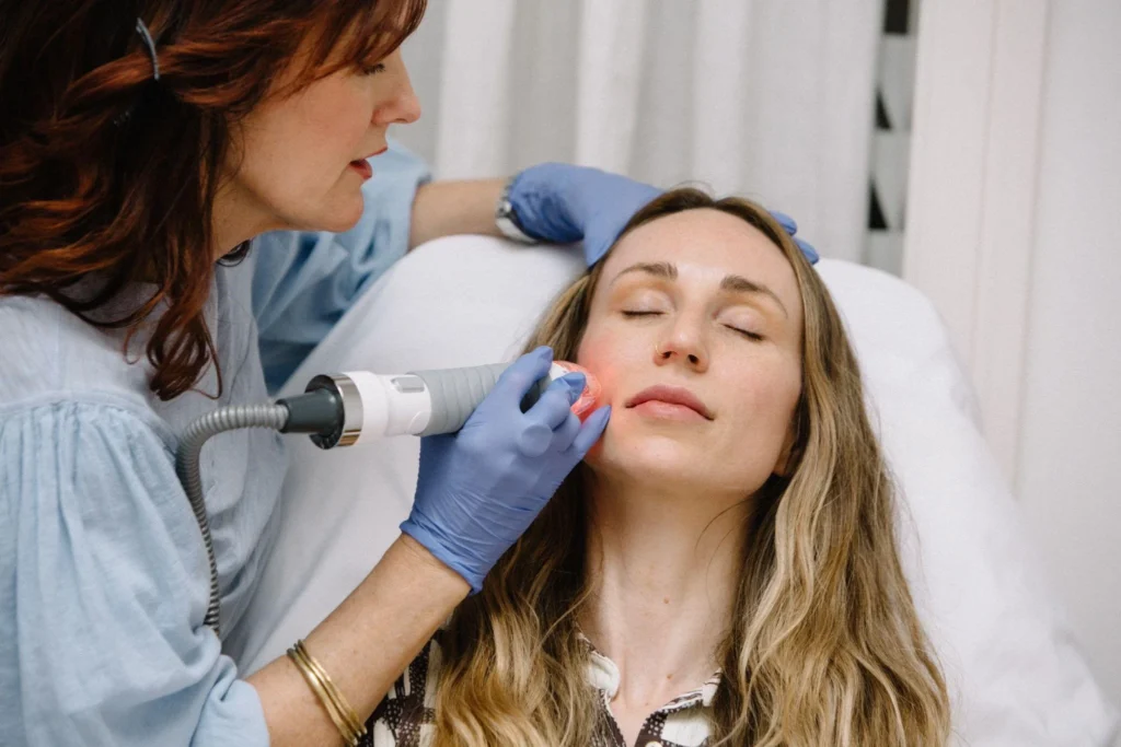 Vivace RF Microneedling In Nevada City | Skin Rejuvenation